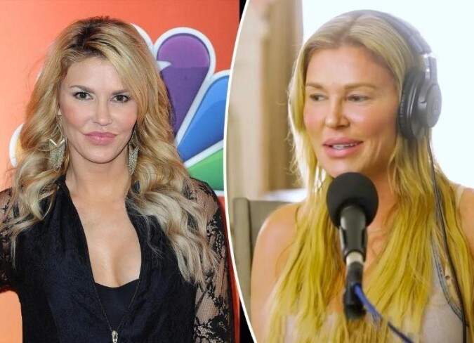 Brandi Glanville's Bad Plastic Surgery 2024: View Before and After ...
