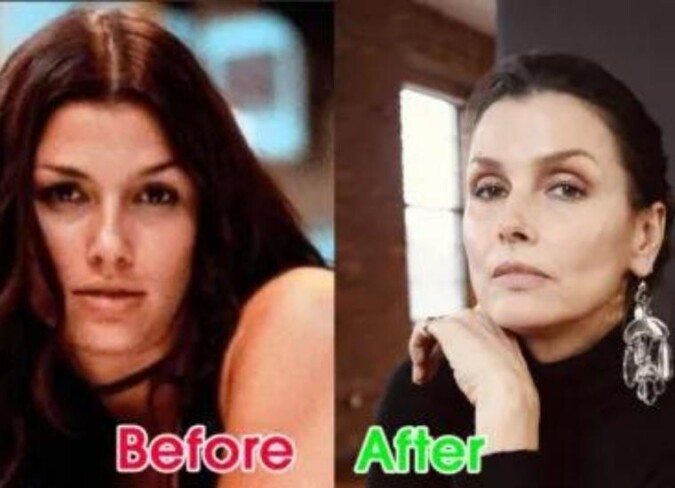 Actress Bridget Moynahan of "Blue Blood" Plastic Surgery Rumors?
