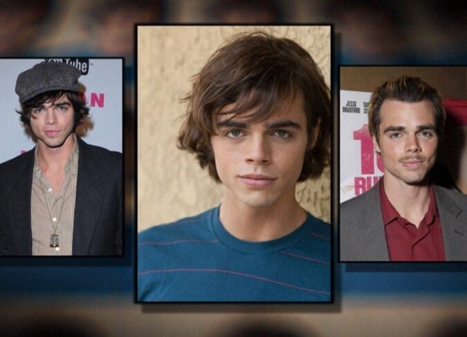 Reid Ewing Plastic Surgery 2024: Why Did the Cast of Modern Family Undergo Surgery?