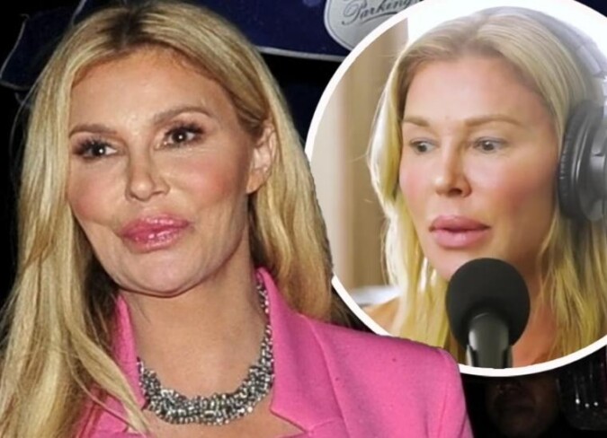 Brandi Glanville's Bad Plastic Surgery 2024: View Before and After ...