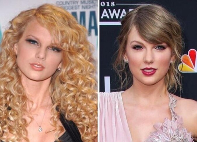 Taylor Swift's Plastic Surgery: Has Taylor Swift Undergone Cosmetic ...