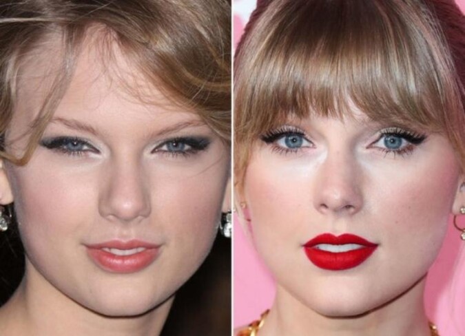 Taylor Swift's Plastic Surgery: Has Taylor Swift Undergone Cosmetic ...