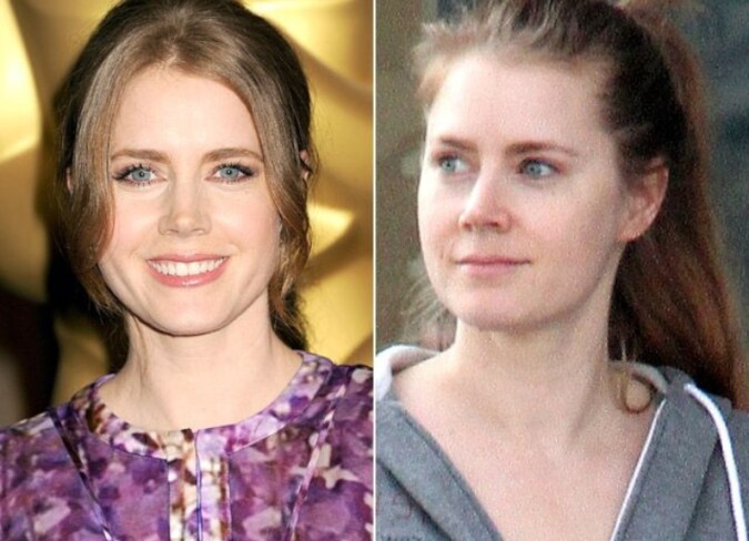 Amy Adams' Plastic Surgery: Did the Cast of "The Enchanted" Have Botox ...