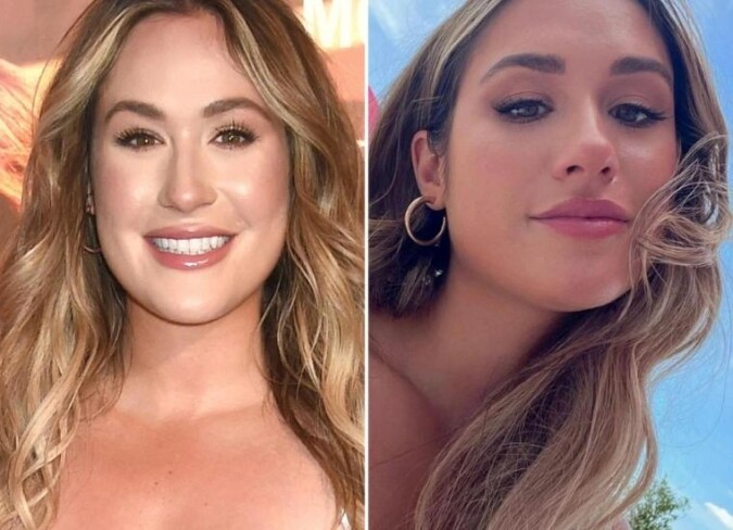 Rachel Recchia Plastic Surgery: See Before and After Photographs of Her ...