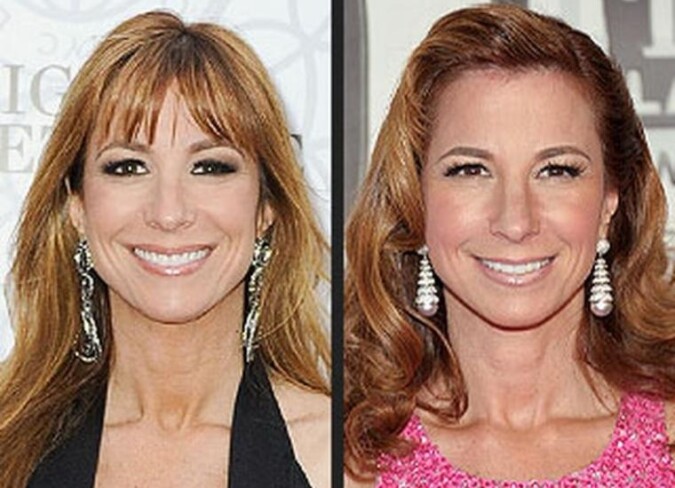 Jill Zarin Plastic Surgery: Did RHONY's 58-year-old Star Get Cosmetic ...