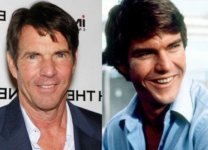 Dennis Quaid's Plastic Surgery: The Blue Miracle Star Underwent Plastic ...