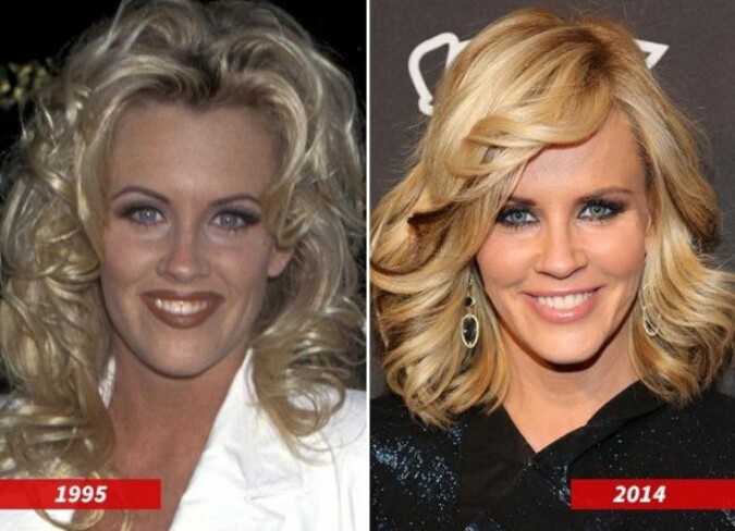 Jenny Mccarthy Plastic Surgery Did She Undergo The Operation