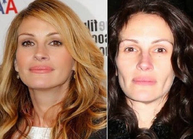 Julia Roberts' Plastic Surgery: What is the Hollywood Icon's Stance on ...
