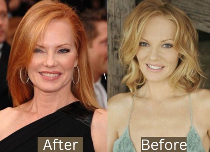 Marg Helgenberger's Plastic Surgery: The CSI Crime Scene Actor Has Not ...
