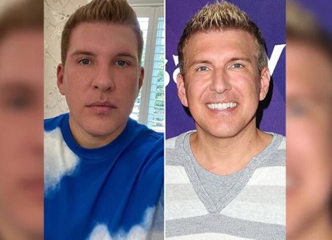 Todd Chrisley's Plastic Surgery: Looking at the 53-Year-Youthful Old's ...