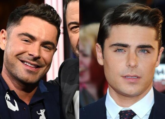 Zac Efrons Plastic Surgery His Explanation For Why His Appearance Has