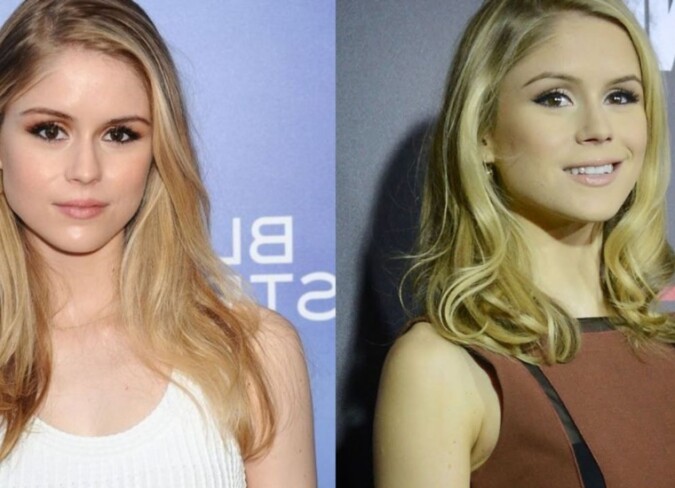 Erin Moriarty Plastic Surgery: Erin Looks Different