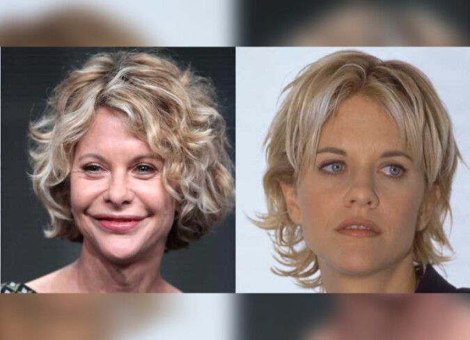 Meg Ryan Plastic Surgery: Ryan Destroyed Her Face With Botox And ...