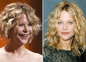 Meg Ryan Plastic Surgery: Ryan Destroyed Her Face With Botox And ...