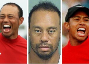 Tiger Woods Plastic Surgery: Woods' Rehabilitation Was Challenging