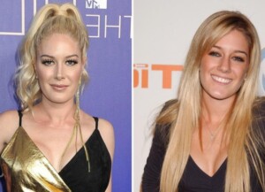 Heidi Pratt Plastic Surgery: Did She Have 10 Cosmetic Surgeries In Just ...