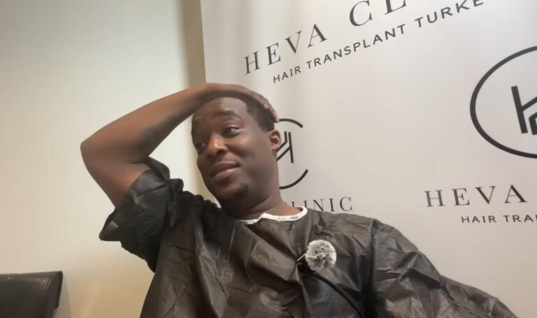 Dub’s Turkish Hairline Experience