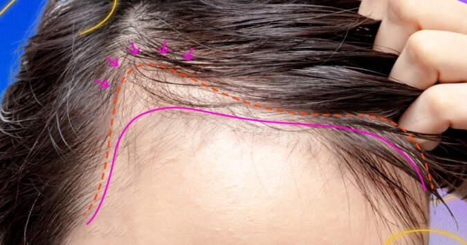 Dub’s Turkish Hairline Experience